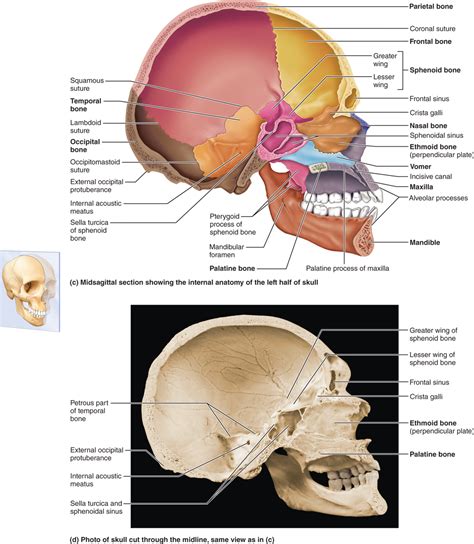 Bone Is Composed Of All Of The Following Except