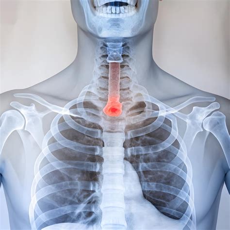 Xray Of Throat Showing Medical Problem Premium Ai Generated Image
