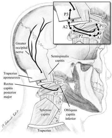 Greater Occipital Nerve