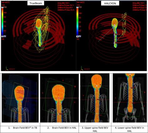 Comparative Dosimetric Analysis Of Volumetric Modulated Arc Therapy Based Dr Biplab Sarkar
