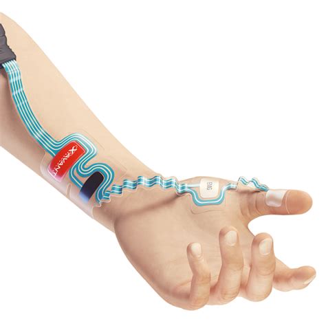 Asa And Easic Guidelines On Monitoring Residual Neuromuscular Blockade Xavant Technology Tof