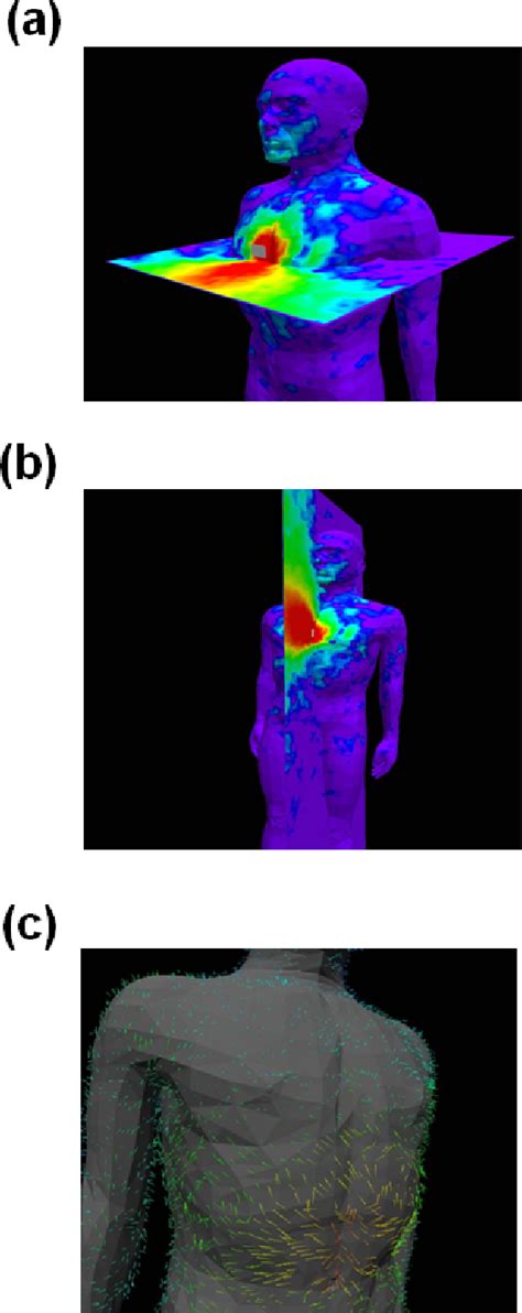 Figure From An Investigation On RF Propagation In The Middle Of Body Area Networks In Virtual