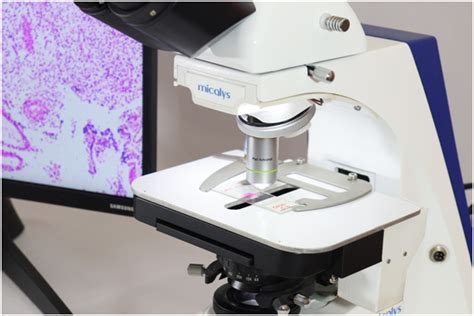 what is automated microscopes and its potential in decentralizing pathology medprime