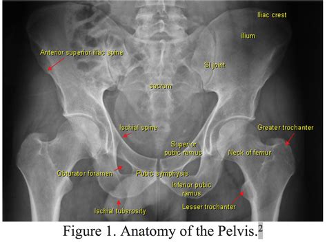 Emergency Medicine Educationpelvic Fractures Ed Presentations And Management