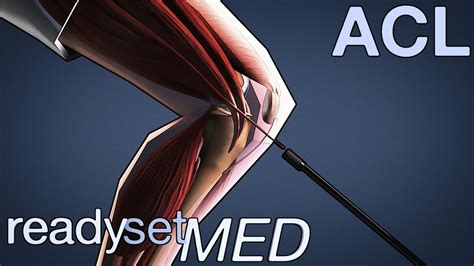 What Is A Hamstring Graft At Therese Arnold Blog