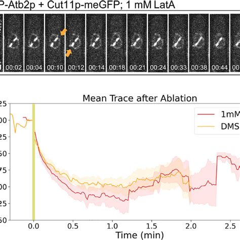 Actin Depolymerization With Latrunculin A Does Not Affect Spindle