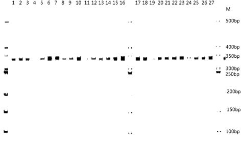 Rapid Molecule Detection Method Of Pinus Massoniana Lamb And Pinus Elliottii And Specific