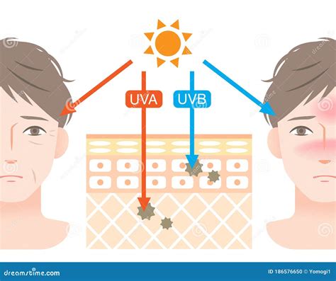 Diagram of Uva and Uvb Penetration into Human Skin with Manâs Face Beauty and Health Care