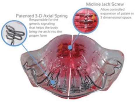 Airway Orthodontics Integrative Dental Arts