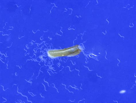 Nematode Delivery Elife Science Digests Elife