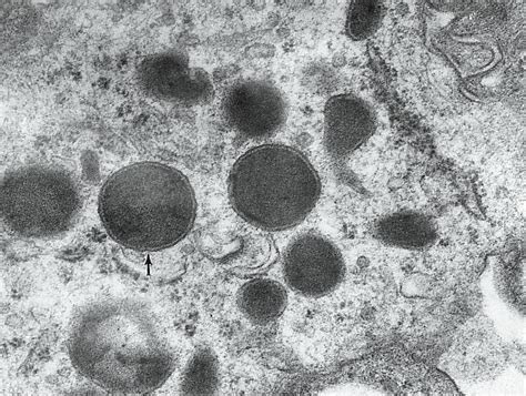 初级溶酶体 组织胚胎学彩色图谱