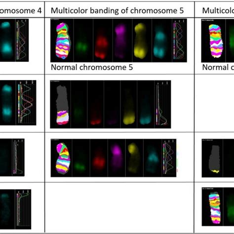 Multicolor Banding Mcb Of Chromosomes 4 5 7 Mcb Analyses Evaluated Download Scientific