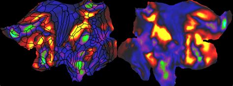 Neurons Circuits And Networks Cambridge Neuroscience