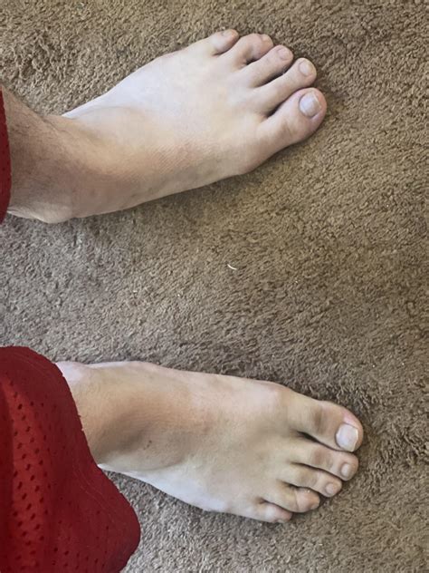 My Feet Suck Rbarefootrunning