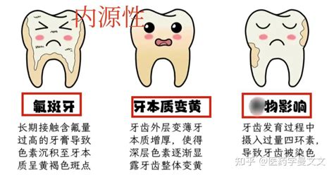 为什么长期刷牙，牙齿还很黄？大部分人都做错了！【医学硕士】教你正确牙齿美白方式，有效改善黄牙，告别无效牙齿美白！！！ 知乎
