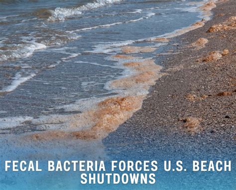 Fecal Bacteria Forces Us Beach Shutdowns