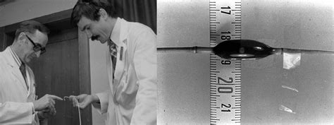 3 Andreas Grüntzig Jubiläums Symposium 45 Jahre Koronarangioplastie Universitätsspital Zürich