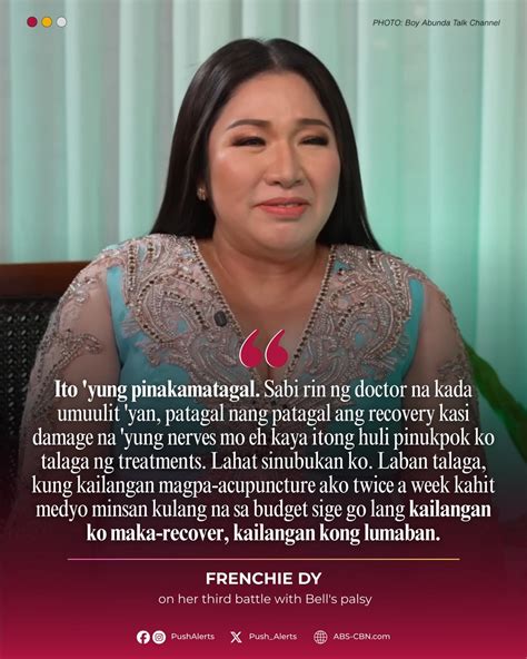 Abs Cbn Singer Frenchie Dy Opened Up About Her Toughest Battle With Bells Palsy Sharing That