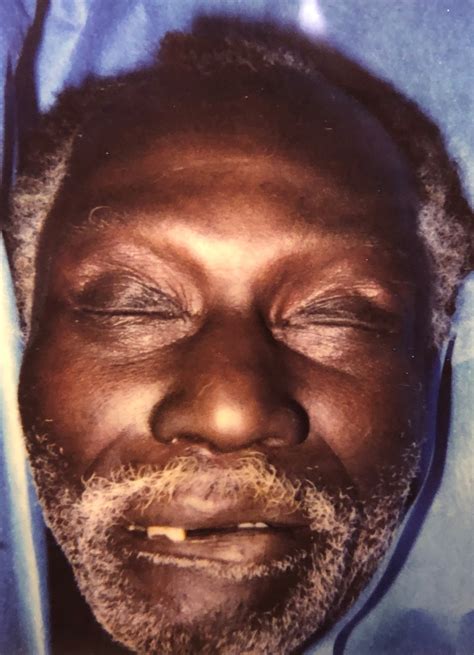 The Nameless Me C Case Number M91 01563 Sex Male Race Ethnicity