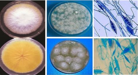Description And Identification And Clinical Importance Of Microsporum Spp Epidermophyton Spp