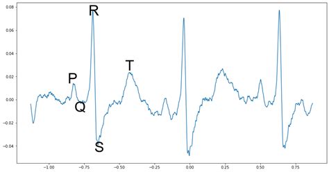 GitHub Mozanunal Digital Filtering Of Ecg Signal Digital Filtering Of A ECG Signal