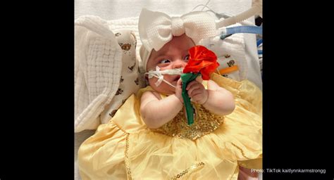 Micro Preemie Girl Outlives Doctors Predictions Dresses Up As Princess Belle In Nicu Live Action