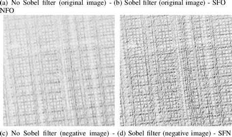 Figure 2 From Convolutional Neural Network Cnn Vs Vision Transformer Vit For Digital