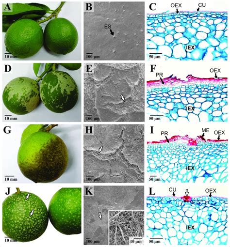 Macroscopic And Microscopic Lesions On The Pericarps Of Healthy Tahiti