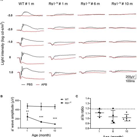 the effect of apb on the dark adapted erg of rs1− y mice and and