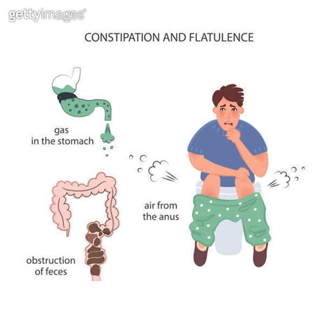 Constipation And Flatulence In Men Air Outlet Through The Anus Gas In