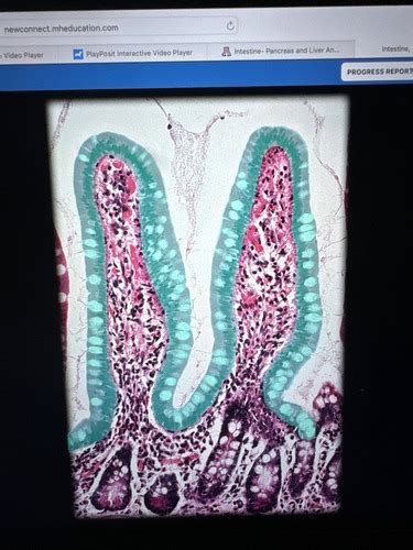 Duodenum Jejunum And Ileum Histology Flashcards Quizlet