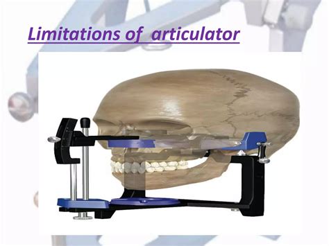 Articulators Parts Classification Limitations Pptx