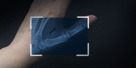 Chipped Human Microchip Implants And Radio Frequency Identification Technology Western