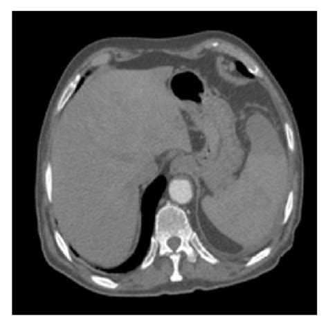 Comparisons Between The Tradition Growcut And Our Improved Approach Download Scientific Diagram