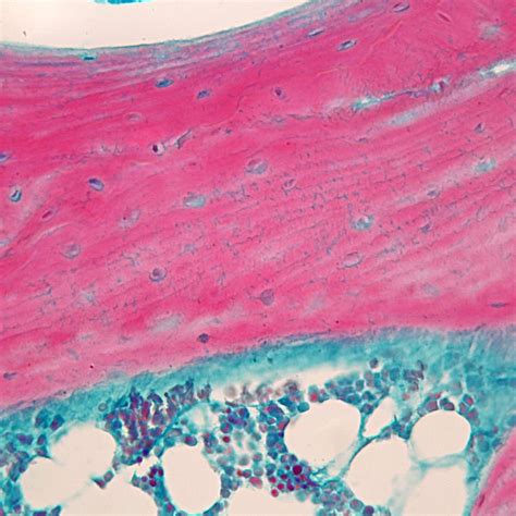 Fibrocartilage Cartilage Slide