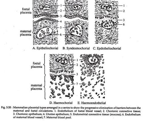 Classification Of Placenta