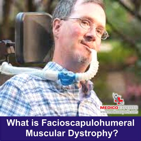 Facioscapulohumeral Muscular Dystrophy Stem Cell Treatment