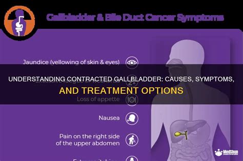 Understanding Contracted Gallbladder Causes Symptoms And Treatment Options Medshun