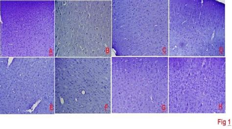 Nissl Staining In Control Group 400x This Nucleus Of Cells In Image