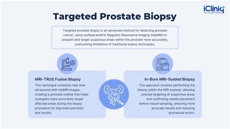 What Is Targeted Prostate Biopsy