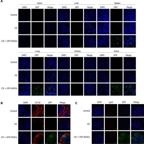 Distribution Of Adipose Derived Mesenchymal Stem Cells And Their
