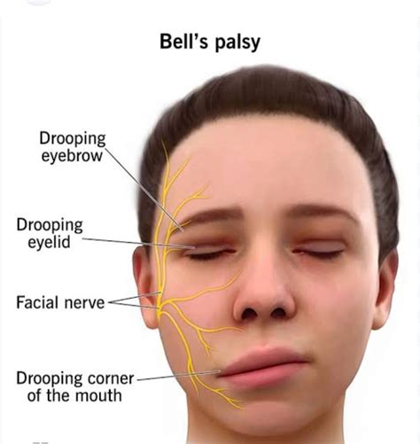 Snehasish Mandal Posted On Linkedin