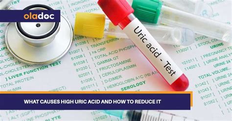 What Causes High Uric Acid And How To Reduce It