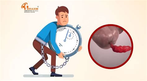 Appendicitis Appendicitis Treatment Diet In Appendicitis Types Of Appendicitis