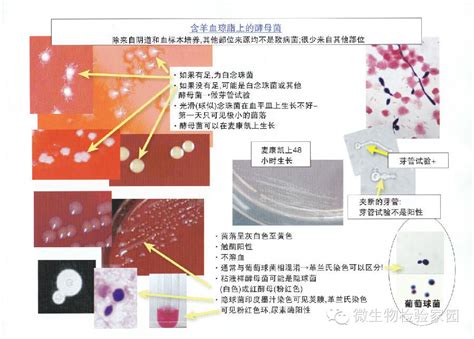 卫生部规范化操作微生物检验流程图 微生物检验 社区 小桔灯网 体外诊断新媒体 IIVD NET