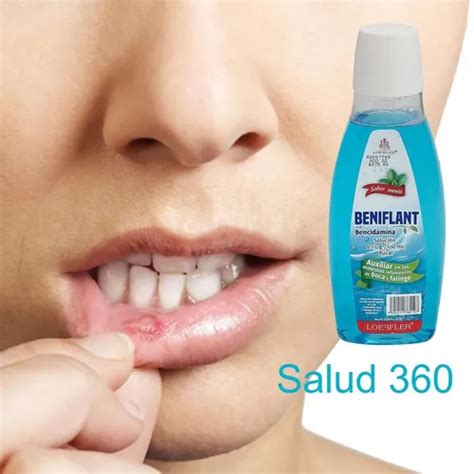 Bencidamina Beniflant Enjuague Bucal 360ml Loeffler 2 Piezas Mercadolibre