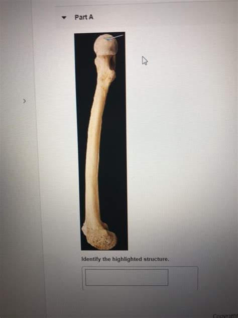 solved part a identify the highlighted bone submit request