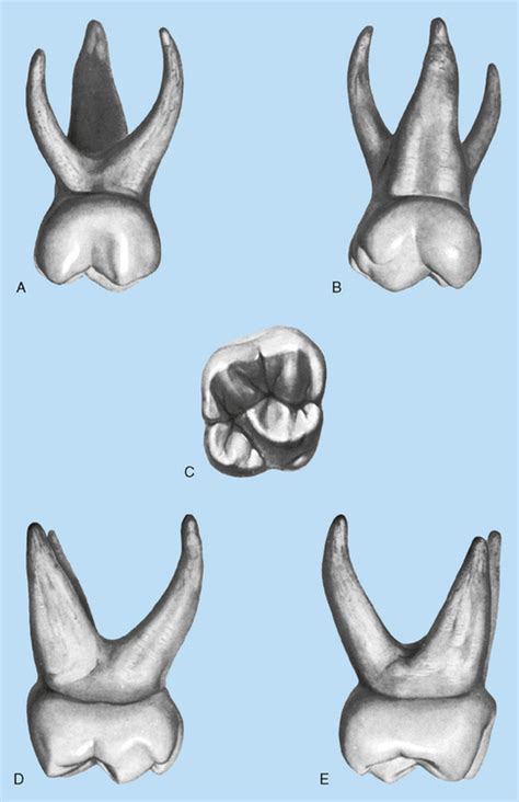 16 Deciduous Dentition Pocket Dentistry