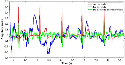 Result Of The Ecg Motion Artifact Correction Download Scientific Diagram