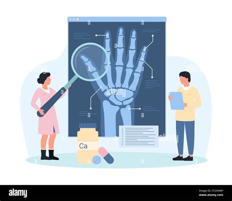 Diagnosis Of Osteoarthritis Rheumatoid Arthritis Using Radiography